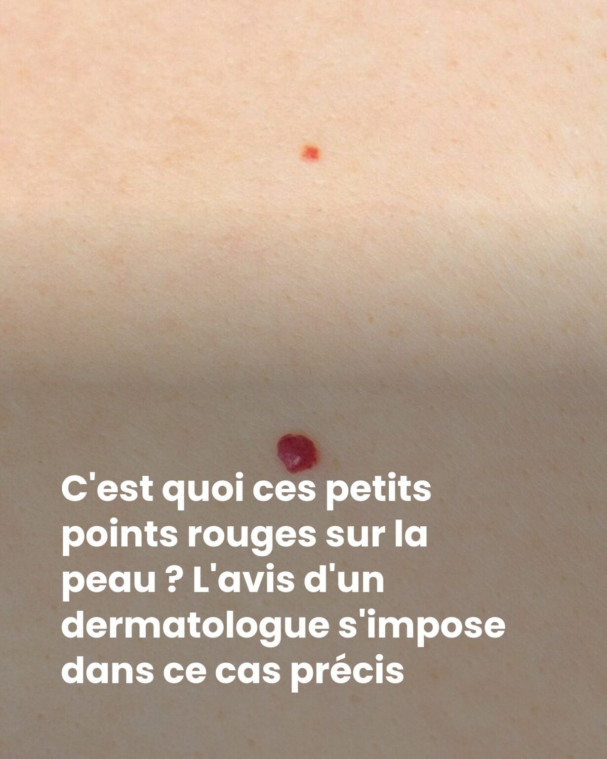 Des petits points rouges sur la peau ? Voici ce qu’il faut savoir ...